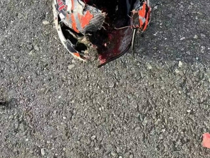 Lào Cai: Học sinh bị xe tải cán nát chân sau khi hoảng loạn chạy ra ...